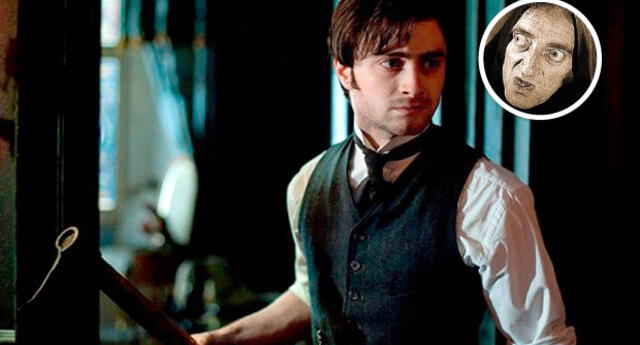 Daniel Radcliffe, del mágico Harry potter a Igor en Frankenstein | El ...