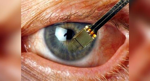 Chips devuelven la visión a pacientes ciegos de Francia | El Popular