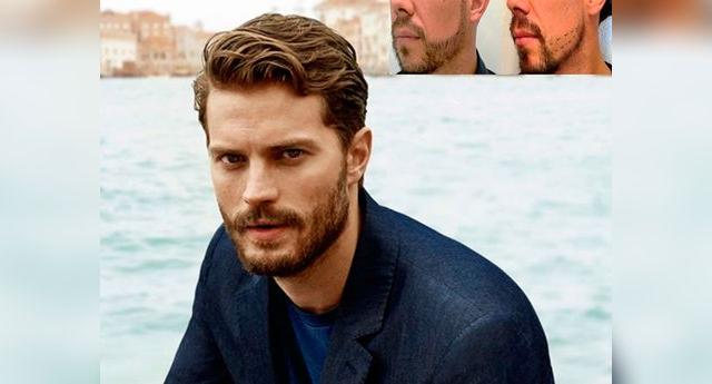 Implante de barba seduce a los peruanos | El Popular