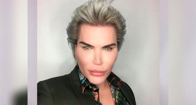 Instagram: Mira cómo luce el 'Ken Humano' tras quitarse 4 costillas y ...
