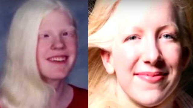 Cindy Crawford: exfotógrafo registra albinas para hacerlas sentir ...