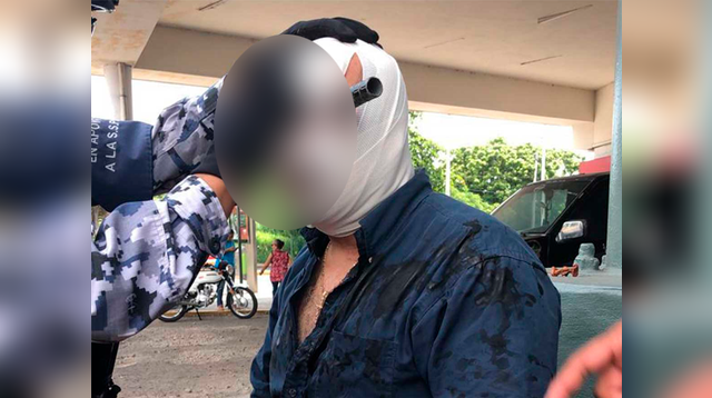 YouTube: hombre termina con desarmador incrustado en el ojo tras pelea ...