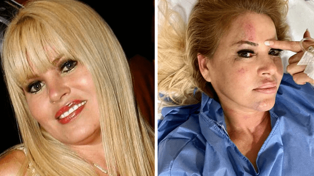 Daysi Ontaneda sufrió fuerte accidente al andar en scooter: "El dolor ...