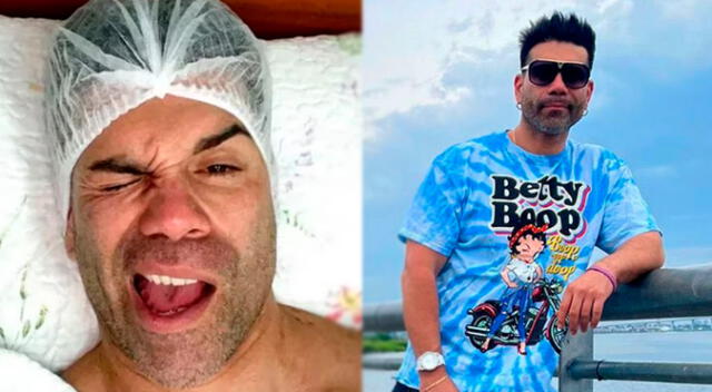 ¿Por qué 'Tomate' Barraza tomó la radical decisión de extirparse las ...